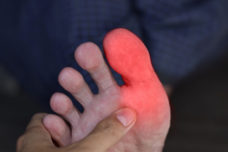 Common Causes of Big Toe Joint Pain